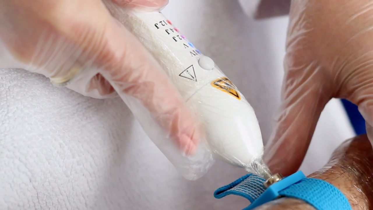 O que é terapia ILIB e quais são os seus benefícios?